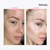 HydraLift™ – Berosely